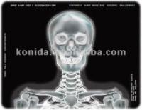 China Medical X Ray Thermal Printer Film KND-F25*30cm for sale