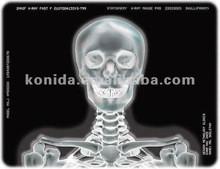 China Medical X Ray Thermal Printer Film KND-F25*30cm for sale