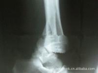 China High Sharpness Wearable Konida Medical Imaging Xray Paper For Laser Printer for sale