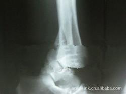 China High Sharpness Wearable Konida Medical Imaging Xray Paper For Laser Printer for sale