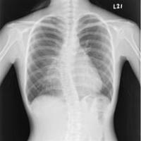 China 10 X 12 Inch X Ray Medical Imaging for sale