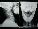 China X Ray Medical Imaging Film for sale