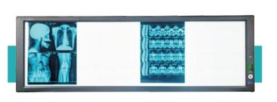 China LED medical super bright viewer box for sale