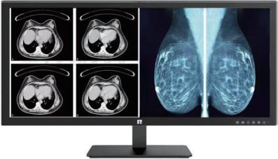 China High-Definition Medical Display with DICOM Compliance for Radiology Grade Imaging for sale