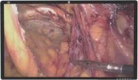 China High-Definition Medical Display with DICOM Compliance for Radiology Grade Imaging for sale