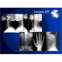 China Mammogrpahy X-RAY Digital Radiography Machine With Flexible UC Arm for sale