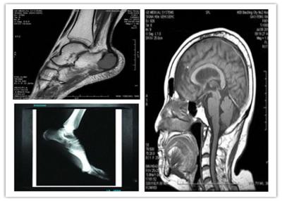 China Medical Digital Blue Base Dry Imaging Film 8 x 10in Compatible Hosipital Mri Scan for sale