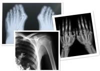 China Thermal Digital X Ray Film Fuji Medical For Radiography Examination for sale
