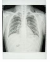 China Konida Laser Printer Medical X-Ray Film 11in x 14in KND-K CE Approved for sale