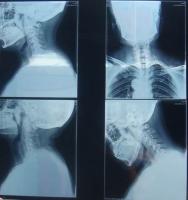 China KND-K Scratch-resistant Medical Paper Dry Imaging Film For Radiographic Examination for sale