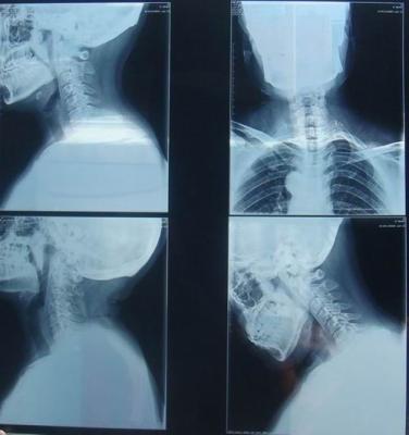 China KND-K Scratch-resistant Medical Paper Dry Imaging Film For Radiographic Examination for sale