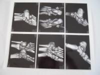 China Medical Dry Imaging Film For X Ray Examination On AGFA 5300, 5302, 5500 for sale