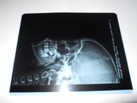China KND-A Konida High Sharpness Medical Dry Imaging Film For Thermal Printer for sale
