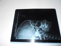 China KND-A Environment friendly Medical Dry Imaging Film For X Ray Examination On AGFA 5300 for sale