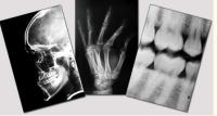 China Blue Medical Dry Imaging Film , 11in x 14in Laser Fuji X Ray Film for sale