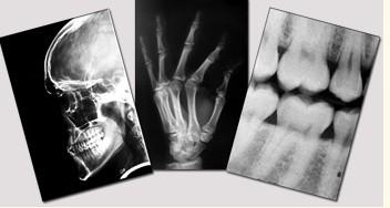 China Blue Medical Dry Imaging Film , 11in x 14in Laser Fuji X Ray Film for sale