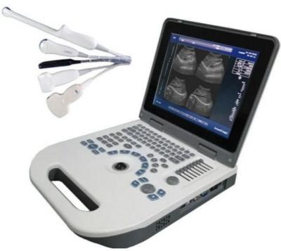 China OEM OB Obstetric Ultrasound Equipment with 12.1 Inch LED Display and 8-Segment TGC Control for sale
