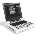 China DICOM Portable 3D Doppler Ultrasound Equipment with 12.1