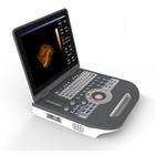 China XF3800 15-inch Portable Color Doppler Ultrasound System with 360mm Depth Range and 160GB Storage for sale