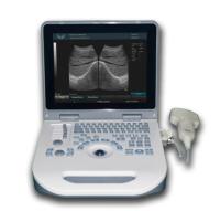 China TGC Control Notebook Ultrasound Scanner with 3.5MHz Probe, 128 Image Storage and Dual USB Ports for Medical Imaging for sale