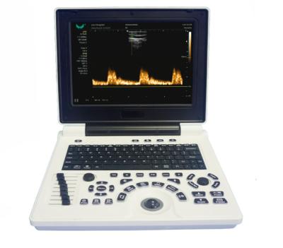 China TGC Control Notebook Ultrasound Scanner with 3.5MHz Probe and 128 Image Storage for Medical Diagnostics for sale