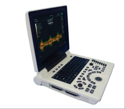 China XF3800 4D Color Ultrasound Portable System with 128GB SSD and 6kg Lightweight Design for Medical Diagnostics for sale