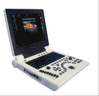 China XF3800 4D Color Ultrasound Portable System with 128GB SSD and 6kg Lightweight Design for Medical Diagnostics for sale