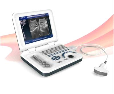 China 10.6-inch Diagnostic Laptop Ultrasound Machine with 256 Gray Scale and 3.5MHz Convex Probe for sale
