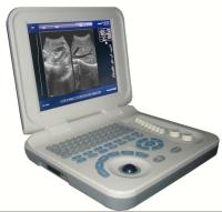China 10.6-inch Diagnostic Laptop Ultrasound Machine with 256 Gray Scale and 3.5MHz Convex Probe for sale