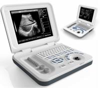 China DRF RDA Portable Ultrasound Scanner with 3.5MHz Convex Probe and 10.4-inch LED Display for sale