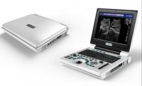 China XF30B Laptop Portable Ultrasound Scanner with 3.5MHz Probe, 11.1V Battery and Dual USB Ports for Medical Diagnostics for sale