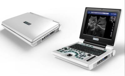 China XF30B Laptop Portable Ultrasound Scanner with 3.5MHz Probe, 11.1V Battery and Dual USB Ports for Medical Diagnostics for sale