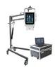 China STXR-Y300 Portable Medical X-ray Machine 12.5kW 130kV with 10.4in Touch Screen and 17x17in Flat Panel Detector for sale