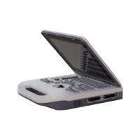 China Xianfeng Portable Ultrasound Scanner with 3.5MHz Convex Probe, 11.1V Battery & USB Interface - Medical Diagnostic Equipment for sale