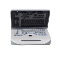 China Xianfeng Portable Ultrasound Scanner with 3.5MHz Convex Probe, 11.1V Battery & USB Interface - Medical Diagnostic Equipment for sale