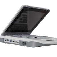 China XF30A Digital Ultrasound Scanner with 12.1in LED Screen, 3.5MHz Probe and 11.1V Battery for sale