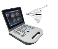 China Portable 3.5MHz R60 Ultrasound Scanner for Home & Clinic Use with 256 Image Cine Loop & 128 Storage for sale