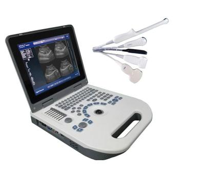 China Portable 3.5MHz R60 Ultrasound Scanner for Home & Clinic Use with 256 Image Cine Loop & 128 Storage for sale