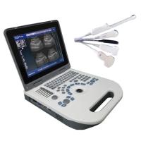China Xianfeng Portable Ultrasound Scanner with 3.5MHz Convex Probe, 11.1V Battery & USB Interface - Medical Diagnostic Equipment for sale