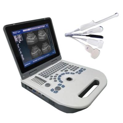 China Xianfeng Portable Ultrasound Scanner with 3.5MHz Convex Probe, 11.1V Battery & USB Interface - Medical Diagnostic Equipment for sale