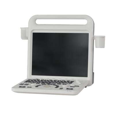 China Xianfeng Portable Doppler Ultrasound Machine CFM PDI with 15-inch LCD Display and 120GB Storage for sale