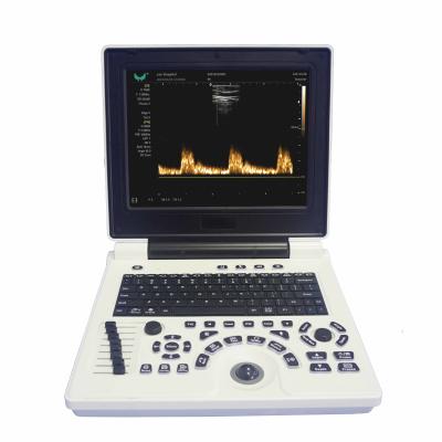 China P20 Portable Laptop Ultrasound System with 12.1