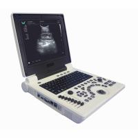China 3D 4D Echography Portable USG Machine For Gynecology Eco for sale