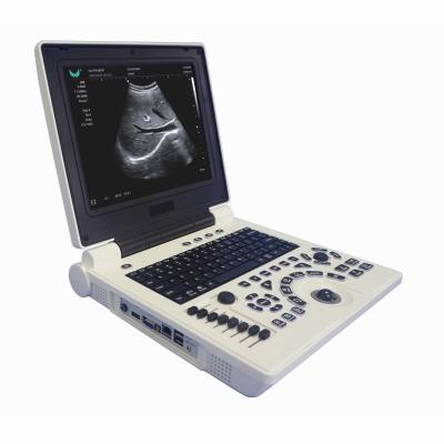 China Portable OB/GYN Color Doppler Ultrasound Machine with 12-inch HD Display and 3200mAh Battery for Pregnancy Diagnostics for sale
