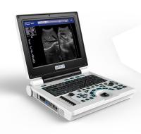 China XF30B Portable Veterinary Ultrasound Machine with 3.5MHz Probe and 11.1V 3000mAh Li Battery for sale