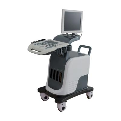 China BPW Mobile Digital Color Doppler Ultrasound System with 15in LED Display, 75kg Weight, 8+ Hour Battery Life for Medical Diagnostics for sale