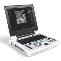 China DICOM Portable 3D Ultrasound Machine with 12.1-inch Display, 3200mAh Battery and 60GB SSD Storage for sale
