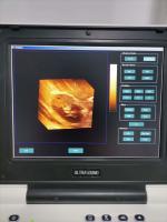 China USG OB GYN Portable Ultrasound Machine with IMT Automatic Measurement 12.1