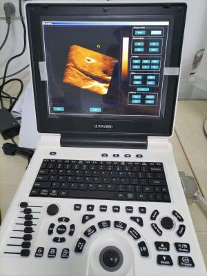 China Xianfeng Pregnancy Color Doppler Ultrasound Machine with 12.1