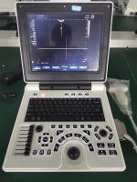 China USG OB GYN Portable Ultrasound Machine with IMT Automatic Measurement 12.1